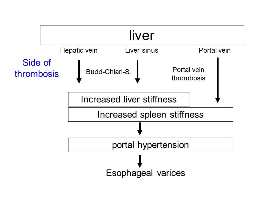 Liver stiffness